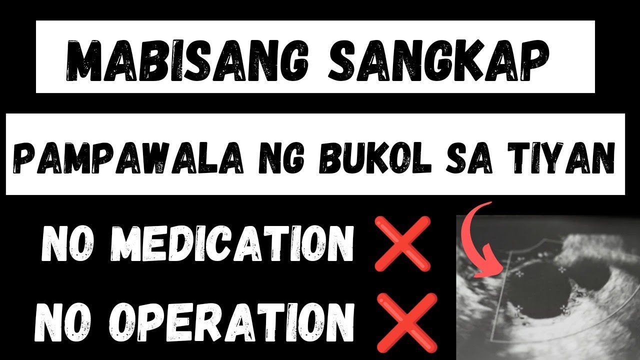 MABISANG SANGKAP PAANO MAWALA ANG BUKOL SA TIYAN #bukolsatiyan #pcos # ...