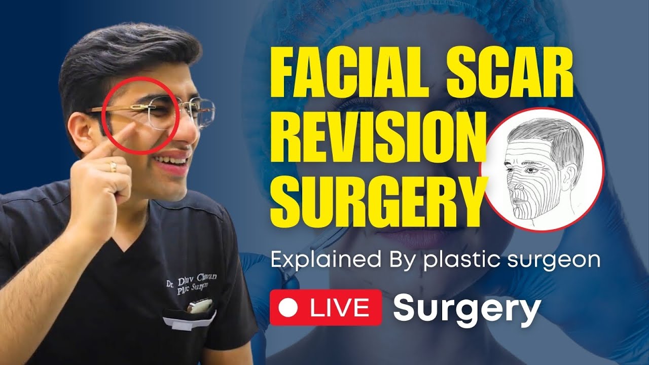 Facial Scar Revision Surgery Explained By Plastic Surgeon : Live ...