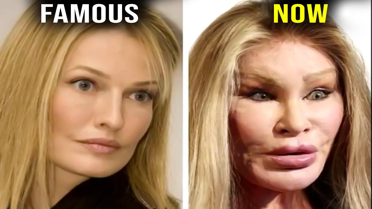 20 Hollywood Celebrities Who Destroyed Their Bodies For Fame - YouTube