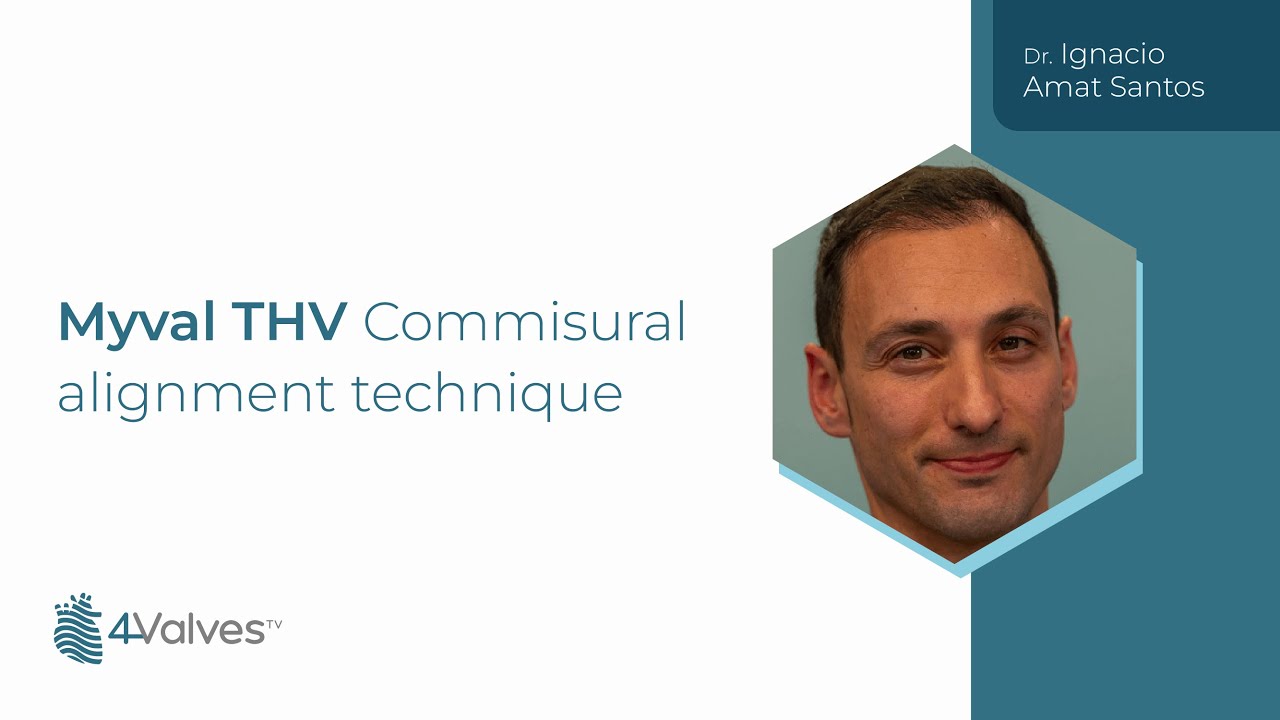 Myval THV Commisural alignment technique - Ignacio Amat - YouTube