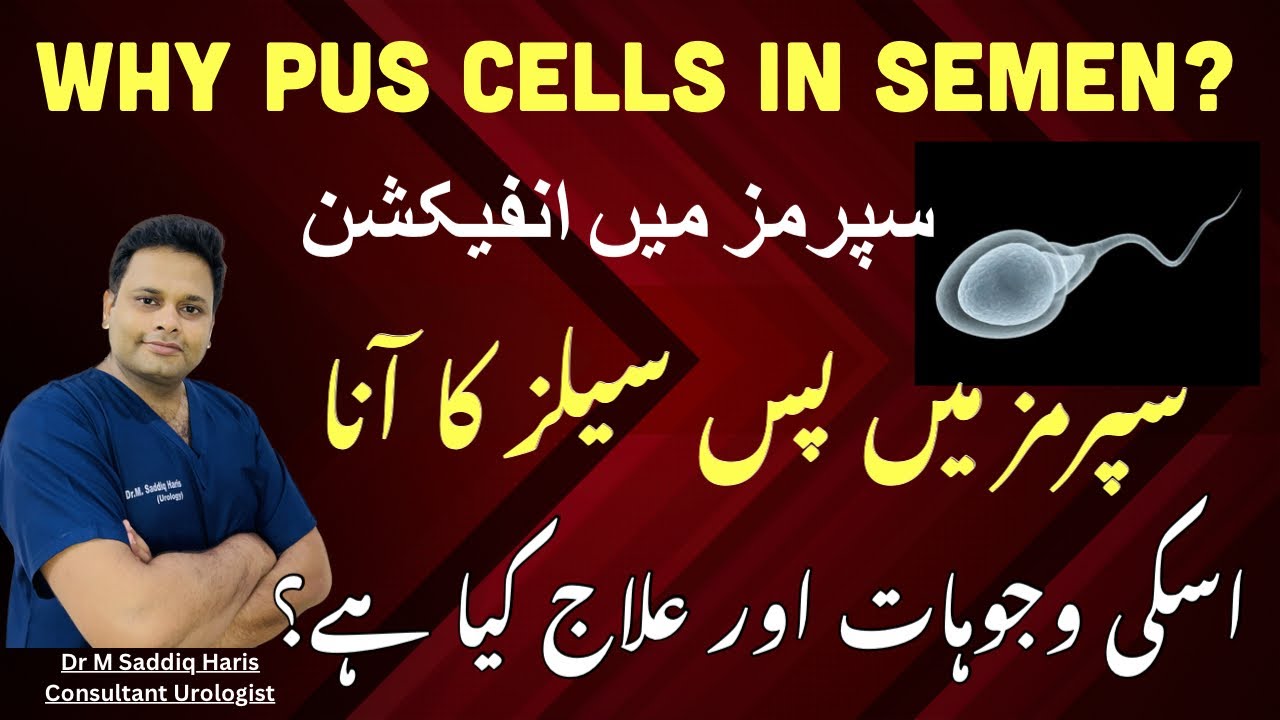 Puss Cells in Semen || Infection in Semen || Causes and Treatment ...