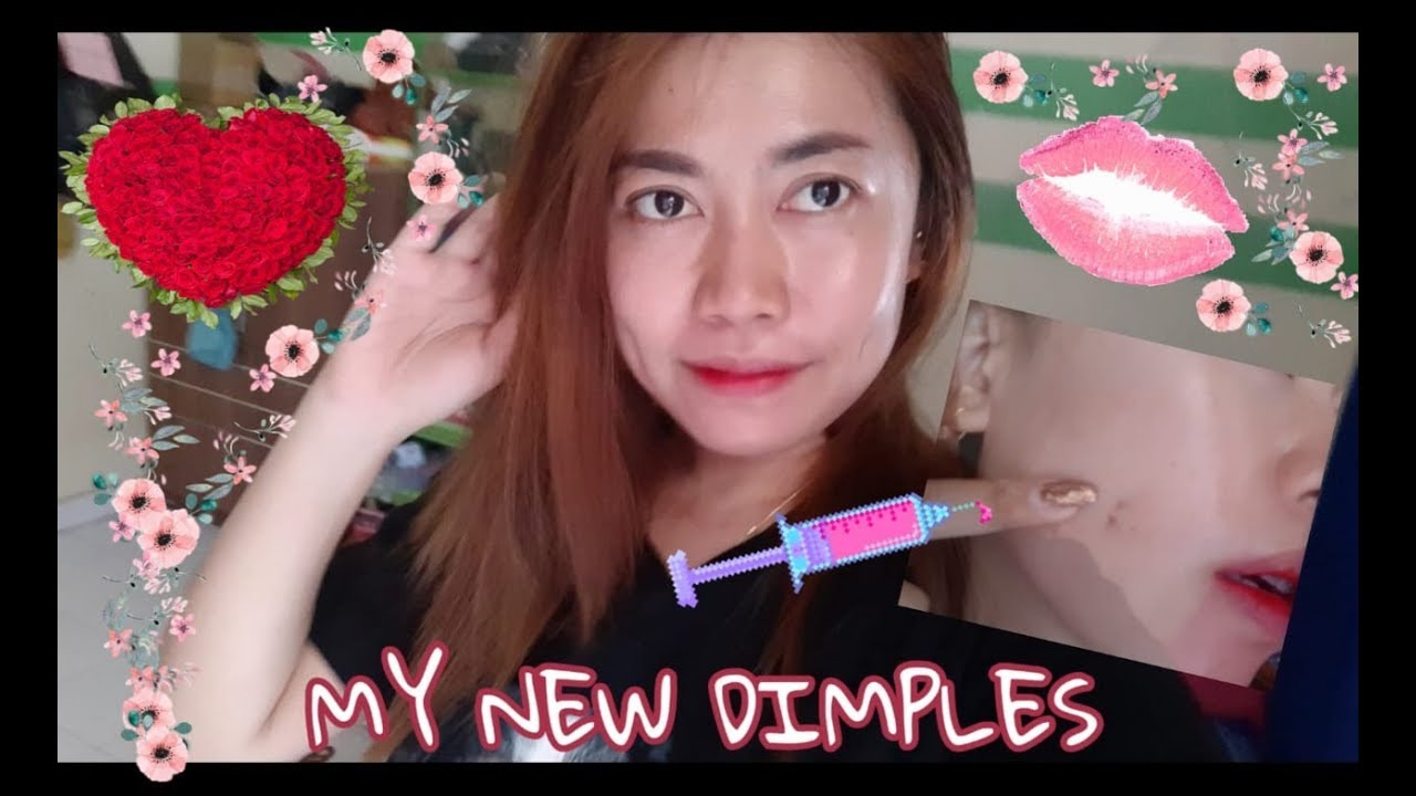 My New DIMPLES !!! OMG.. (sulam lesung pipi) - YouTube
