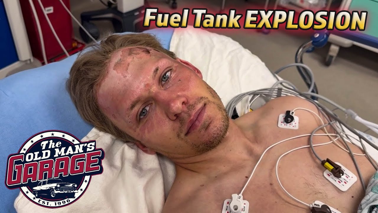 FUEL TANK EXPLOSION LEAVES BILLY HOSPITALIZED. - YouTube