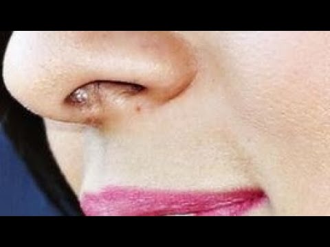 Actress Sushmita Sen Hd Nose Hole and Lips Closeup - YouTube