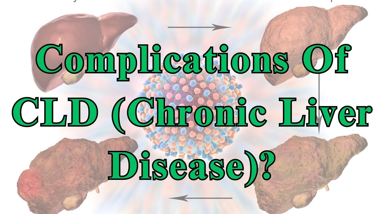 Complications Of Chronic Liver Disease CLD YouTube