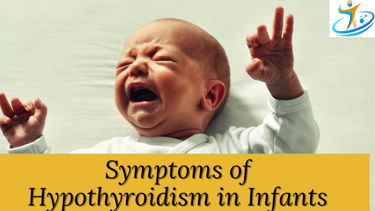 Symptoms Of Hypothyroidism In Infants - YouTube