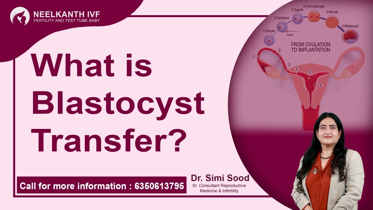 IVF Blastocyst Transfer | How to IVF Blastocyst Transfer - YouTube