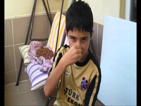 burnunu kıran çocuk