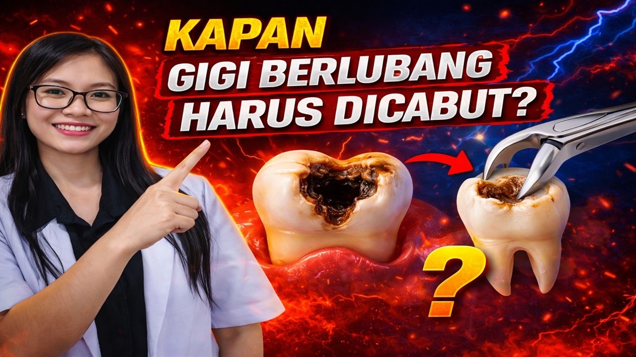 Kapan Gigi berlubang harus dicabut ? #doktergigichannel - YouTube