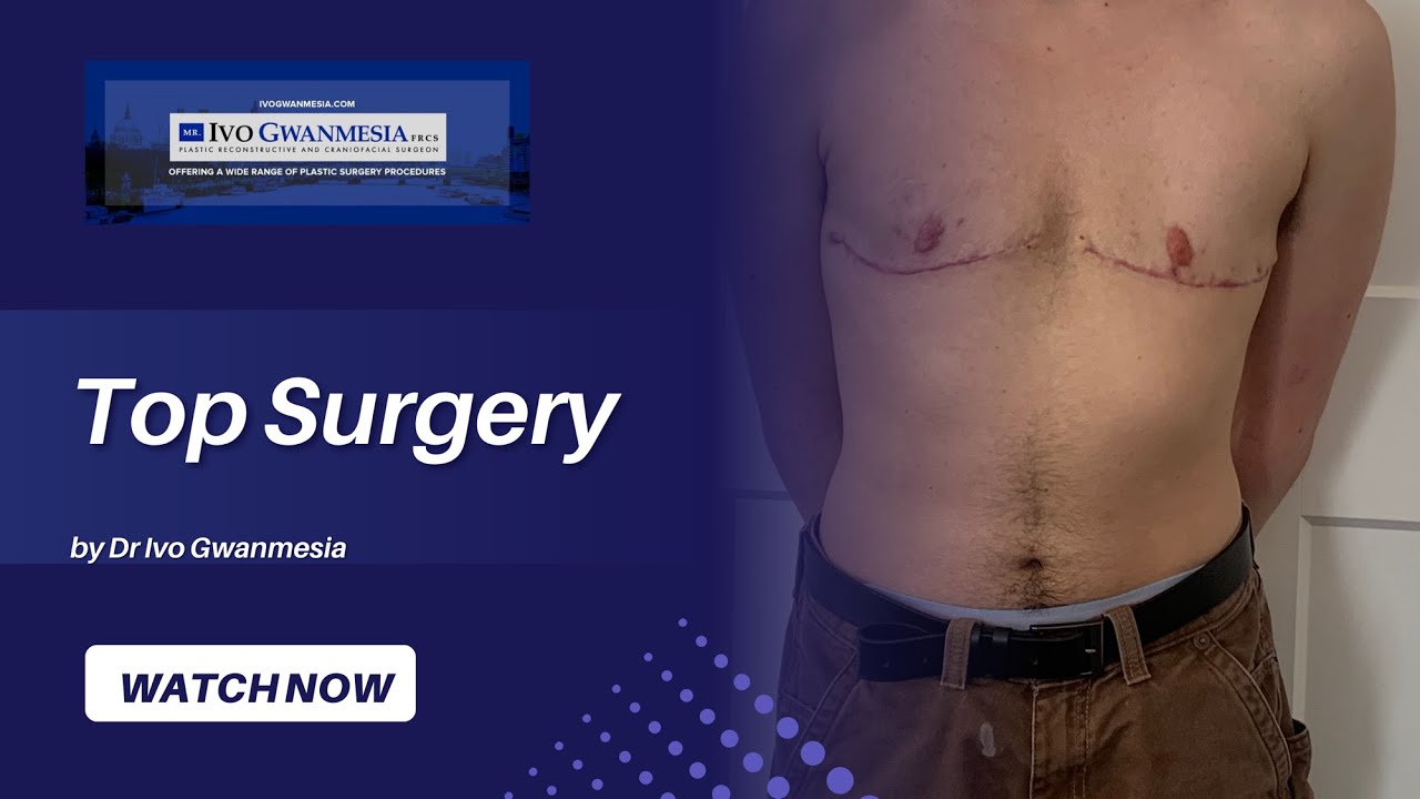 Female to Male TOP Surgery - expert advice from Harley Street surgeon ...