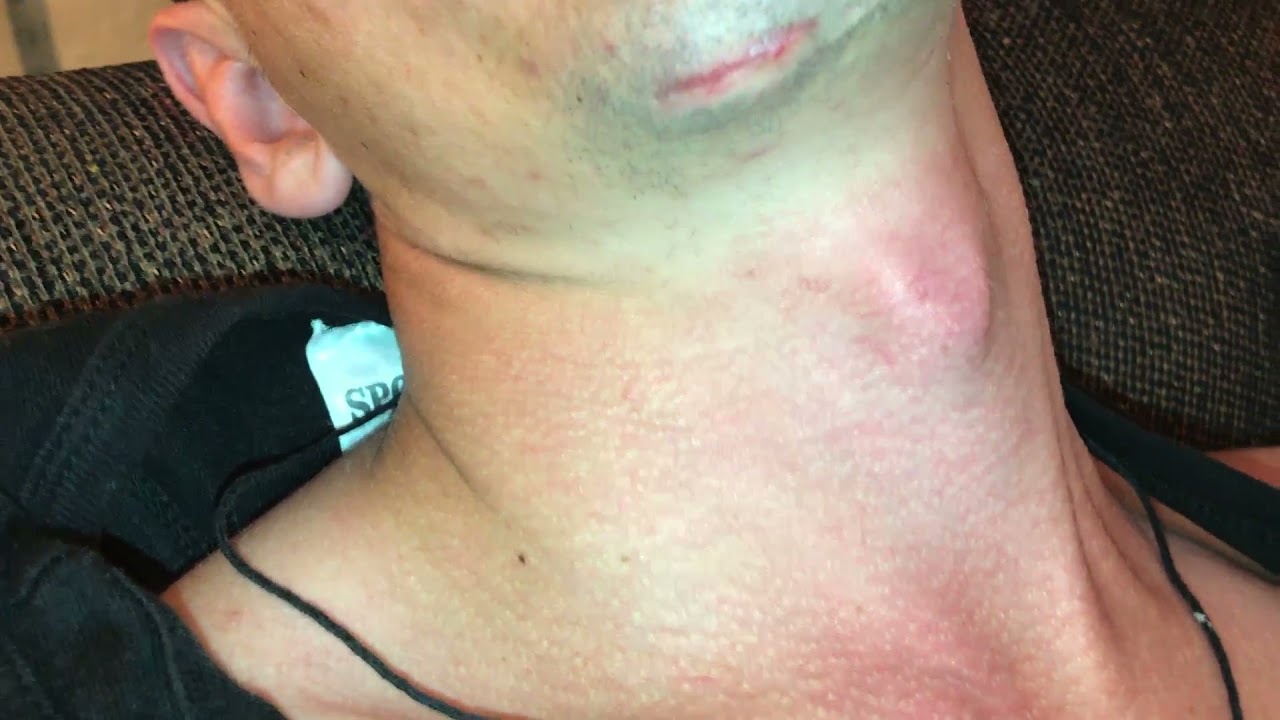 Adam's apple - YouTube