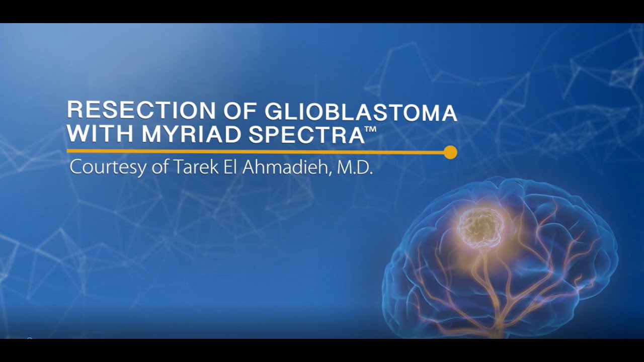 Myriad SPECTRA GBM Resection By Dr El Ahmadieh - YouTube