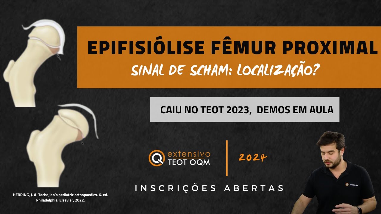 Sinal de Scham na Epifisiólise apareceu no TEOT 2023, demos em aula! # ...