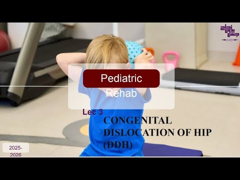Congenital Dislocation of the Hip , Pediatric Rehab , Lec 3 - YouTube
