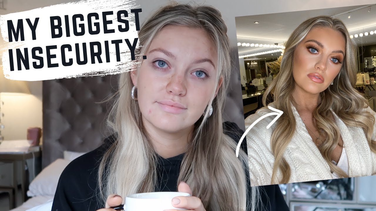 OPENING UP ABOUT MY BIGGEST INSECURITY. (answering your QS...) - YouTube