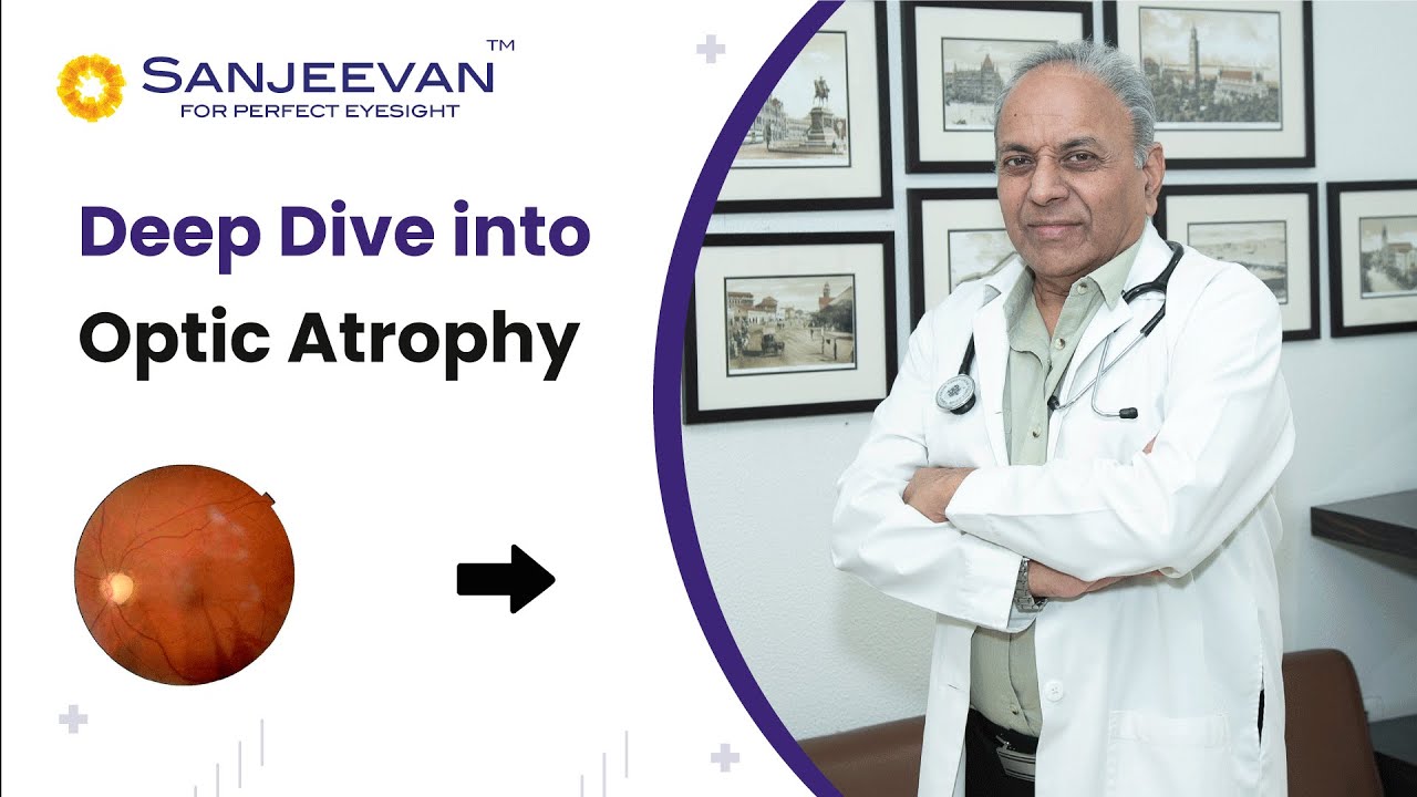 Deep Dive into Optic Atrophy | Causes, Symptoms, and Treatment Options ...
