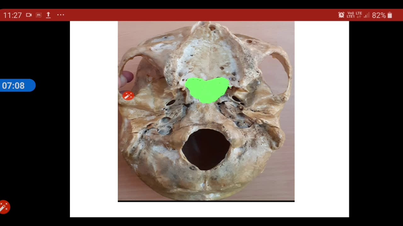 Anatomy of the soft palate - YouTube