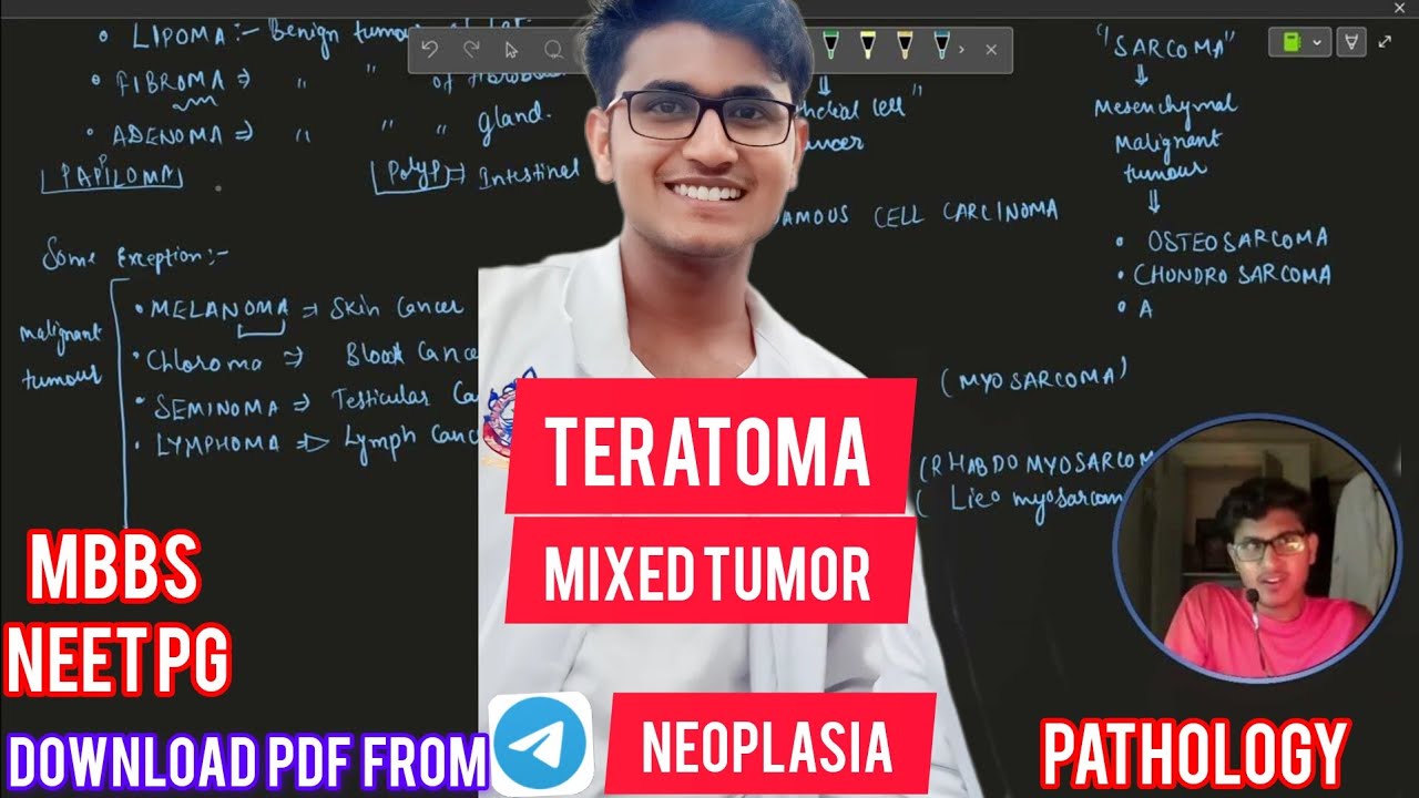 3. Teratoma and mixed tumor (neoplasia) along with examples |neoplasia ...