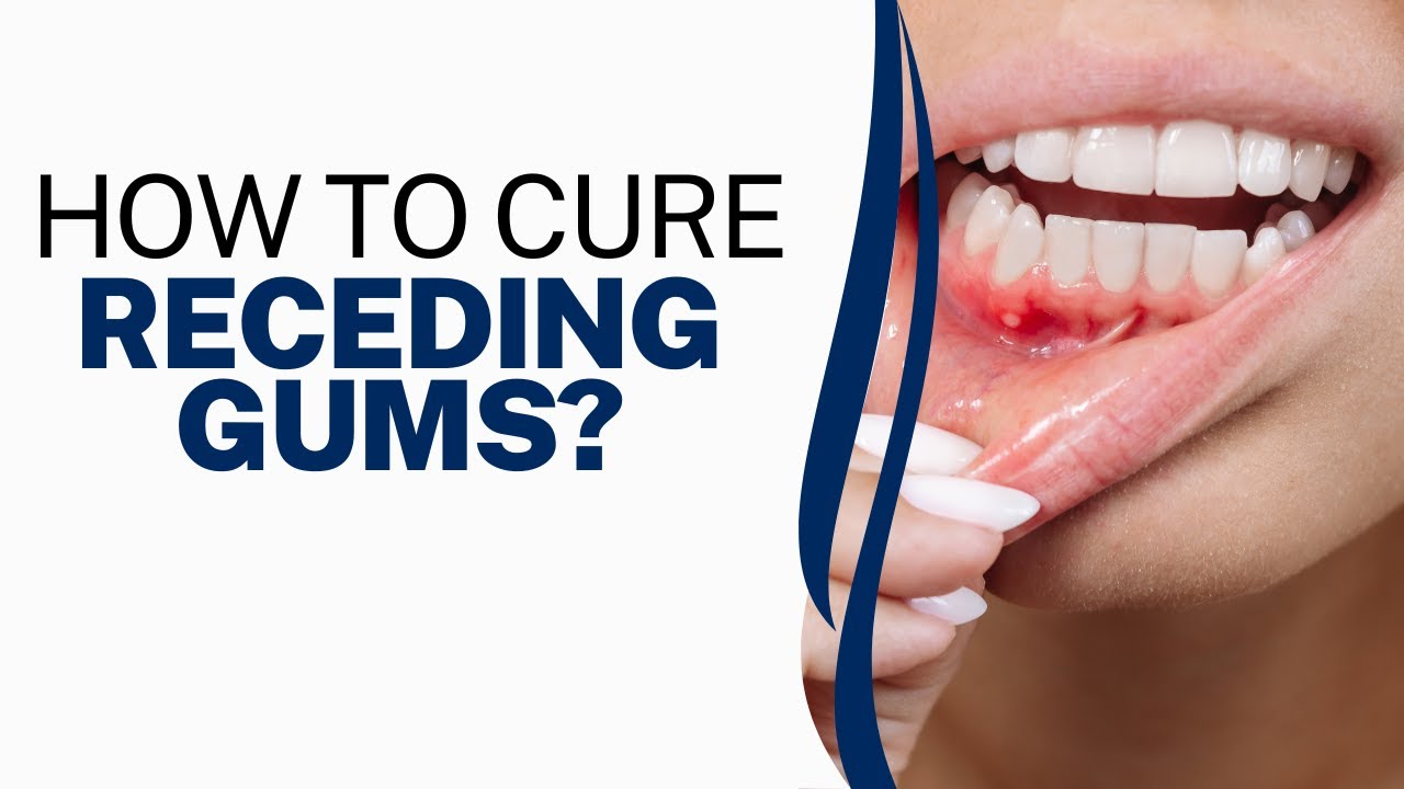 How To Cure Receding Gums 4 Proven Tips And Natural Remedies Youtube