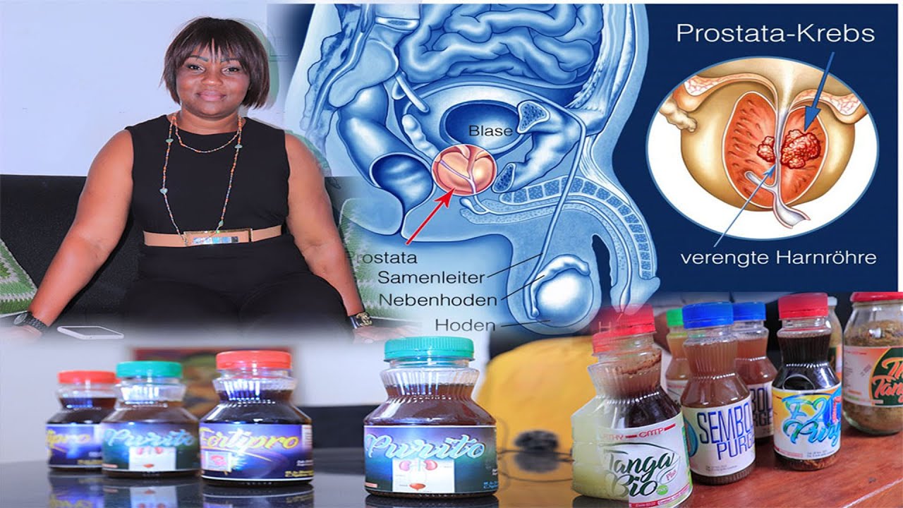 😭URGENT!! BOTALA CONSÉQUENCE YA PROSTATE, PRESIDENT EN PLEIN DISCOURS ...