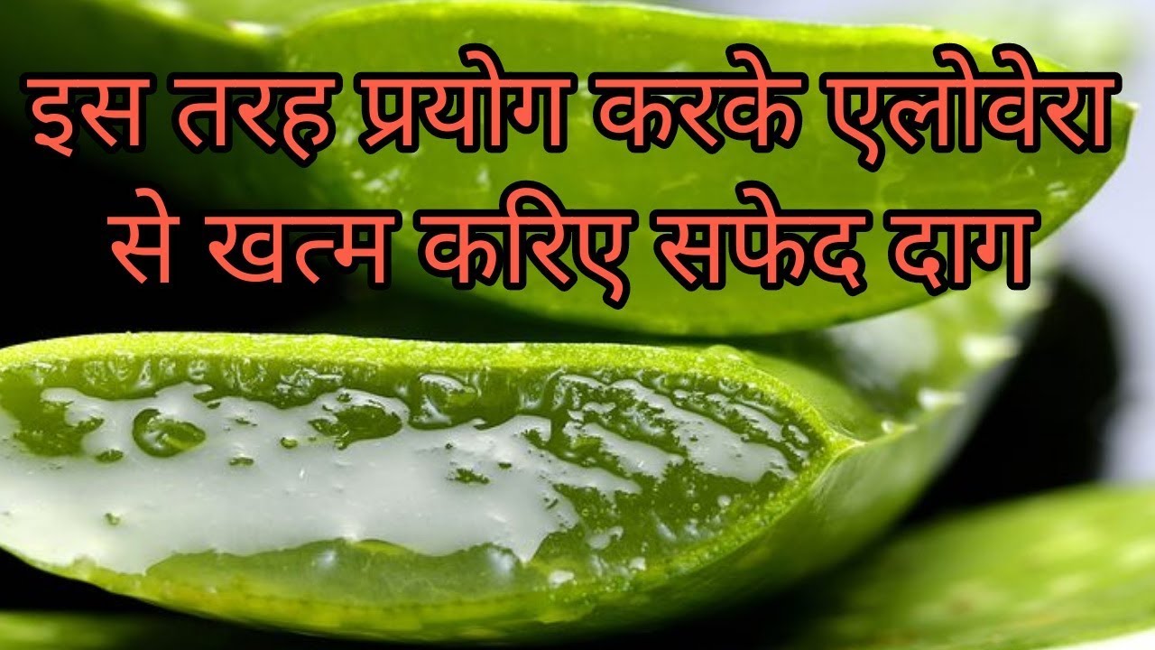सफेद दाग का इलाज,white spots treatment home,safed daag ka ilaj - YouTube