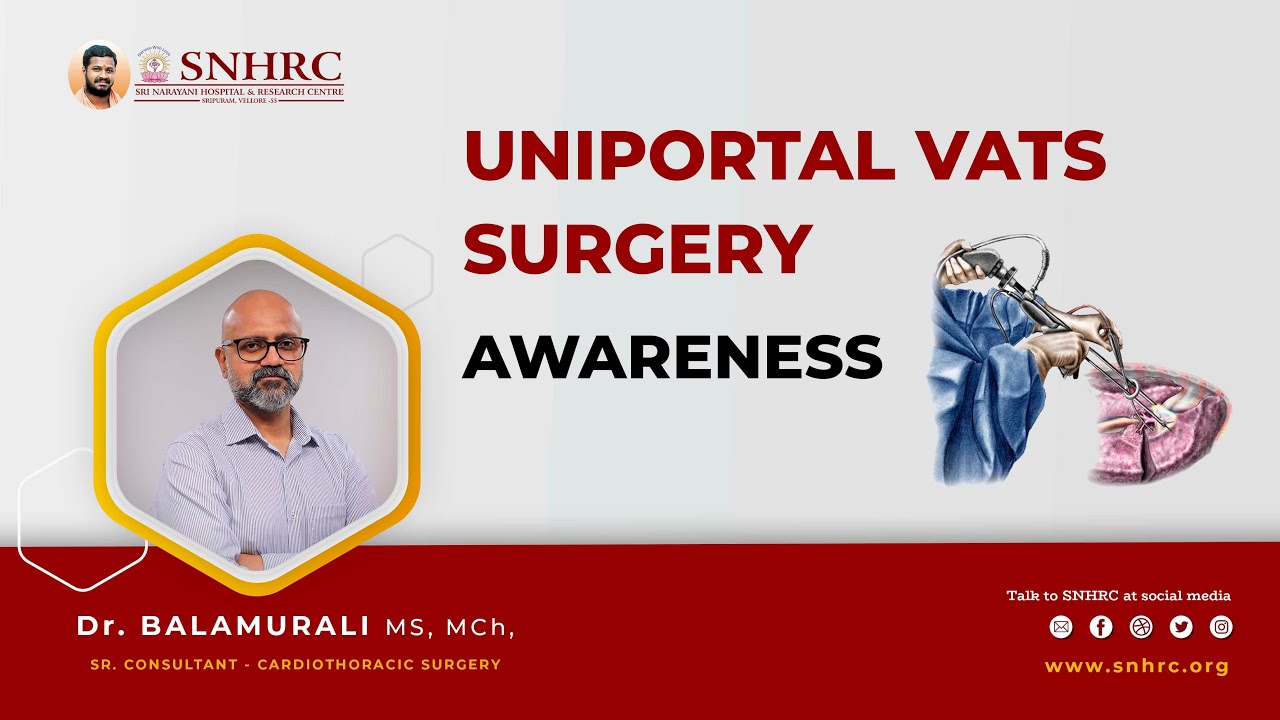 Uniportal VATS Surgery Awareness | Dr. Balamurali - Cardio thoracic ...