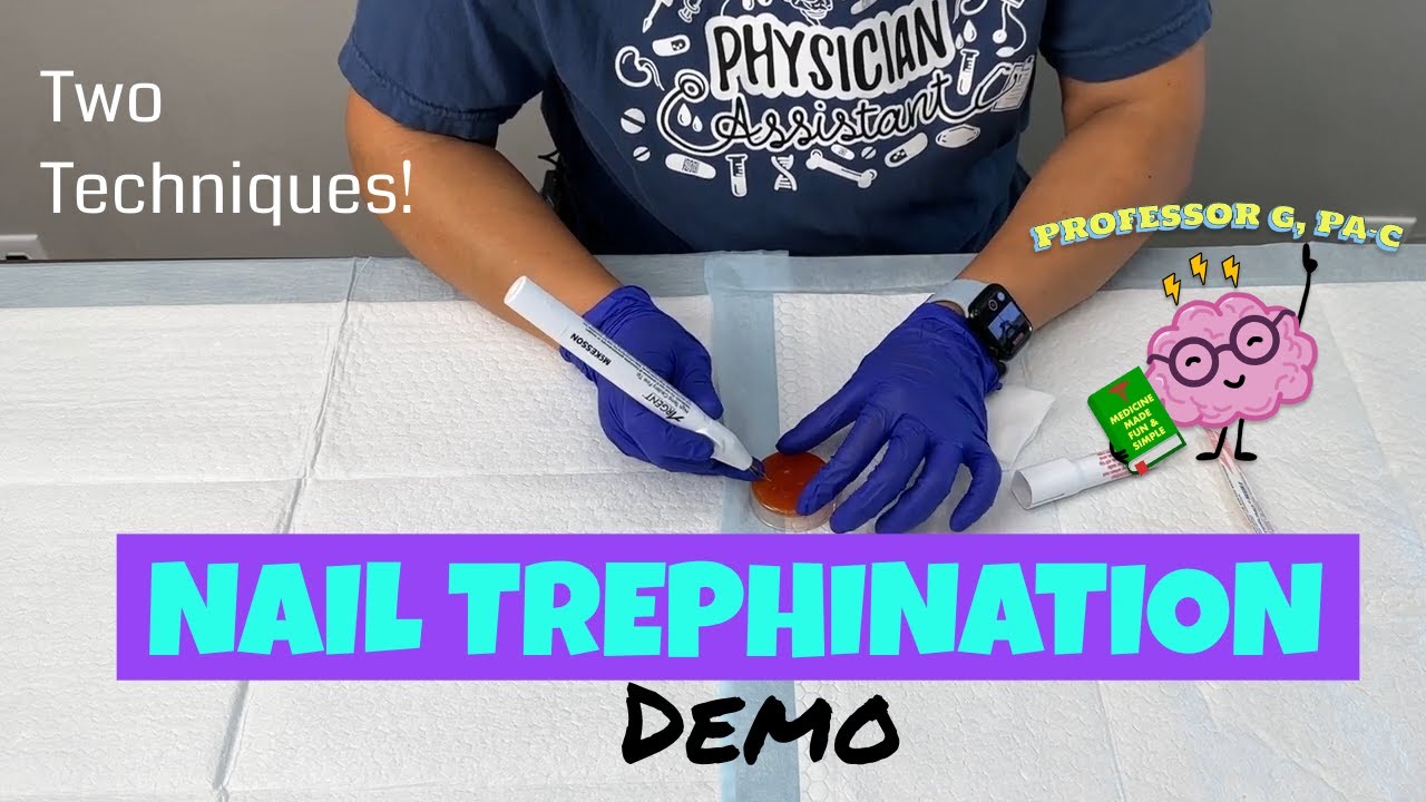 Nail Trephination on Homemade Demo - YouTube