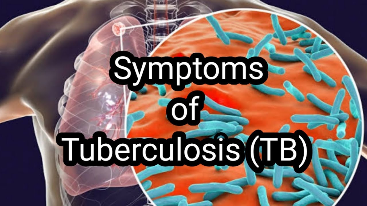 Symptoms of TB. Tuberculosis symptoms. Lungs TB. Colours of life. - YouTube