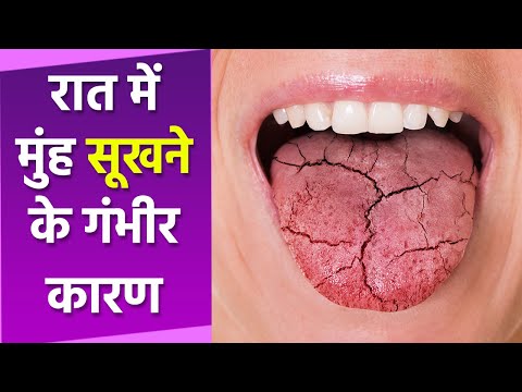 रात को मुंह सूखने का कारण । रात को मुंह क्यों सूखता है जानिए लक्षण  और उपाय। Boldsky *Health