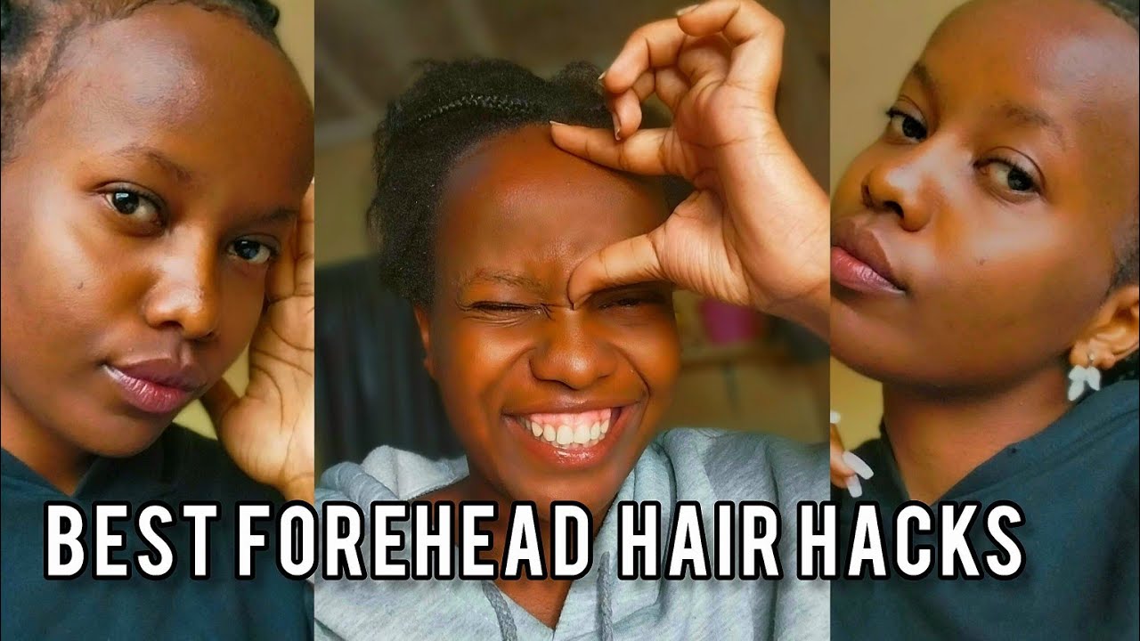 BEST FOREHEAD HAIRSTYLE & HAIR GROWTH video MUST WATCH - YouTube