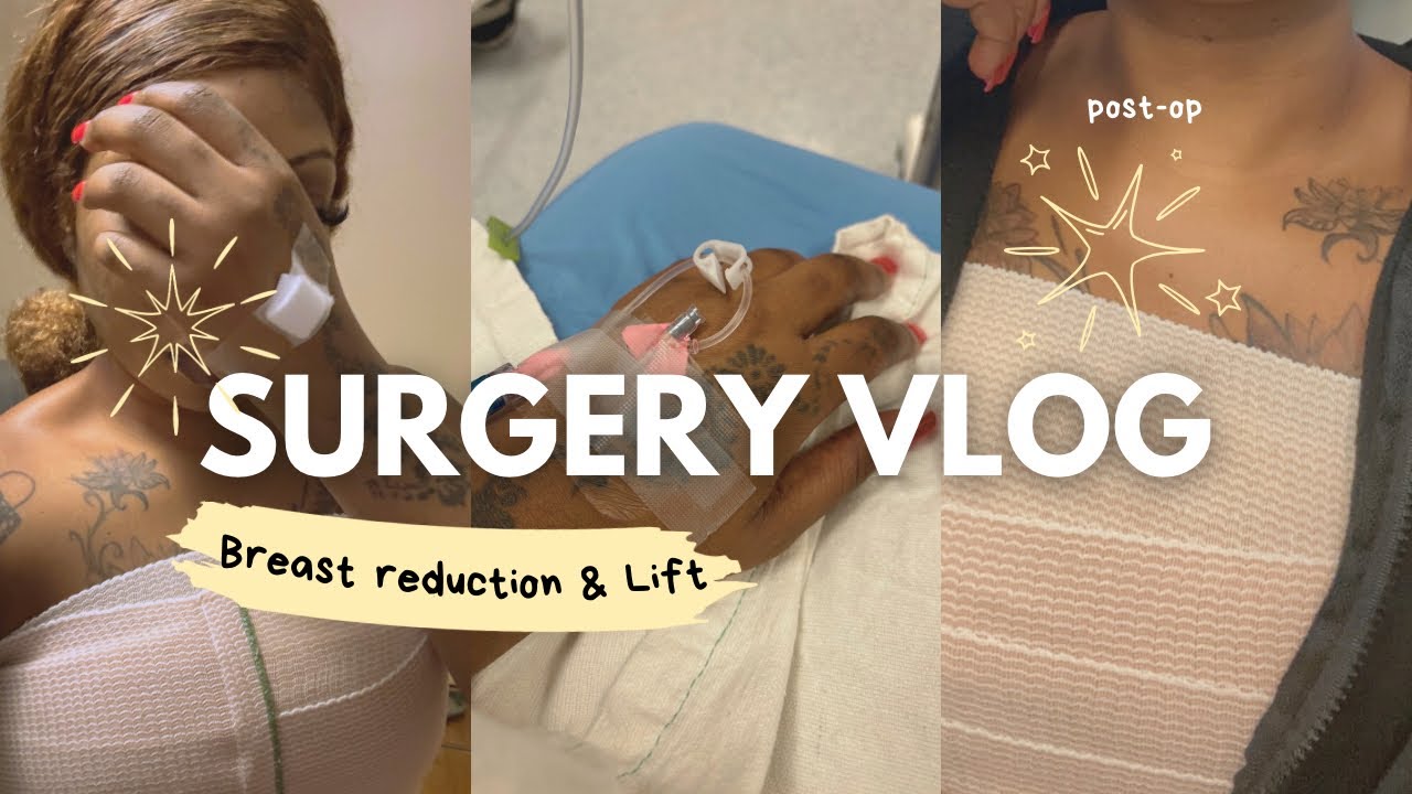 BREAST REDUCTION + BREAST LIFT SURGERY | WHAT YOU NEED TO KNOW BEFORE ...