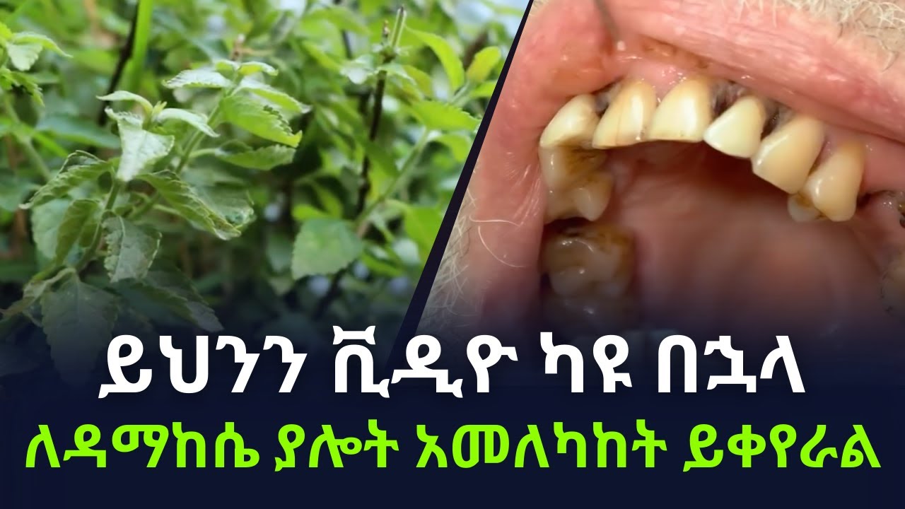 🔴ይህንን ቪዲዮ ካዩ በኋላ ለዳማከሴ ያሎት አመለካከት ይቀየራል || ዳማከሴ እንዲህ ነው ለካ || ethiopia ...