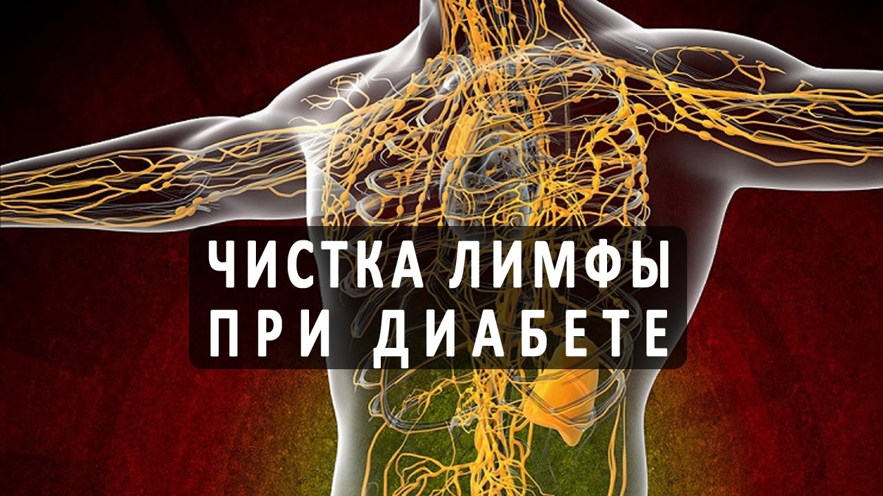 Чистка лимфы при сахарном диабете - YouTube
