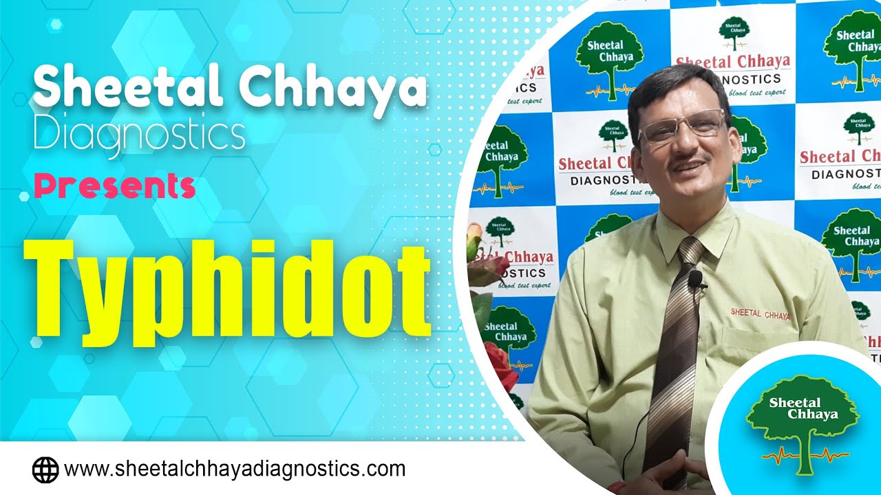 TYPHOID FEVER :SIGN SYMPTOM TEST | THPHIDOT TEST IGM IGG | TYPHIDOT ...