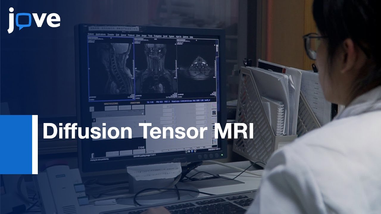Diffusion Tensor MRI in Chronic Spinal Cord Compression | Protocol Preview - YouTube