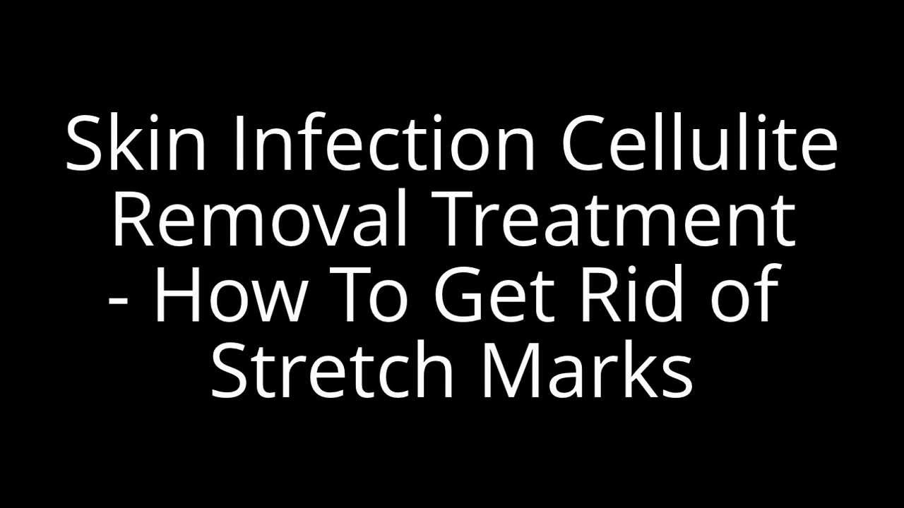 Skin Infection Cellulite Removal Treatment - How To Get Rid of Stretch ...