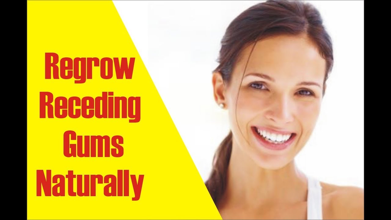 Regrow Receding Gums Naturally At Home - YouTube