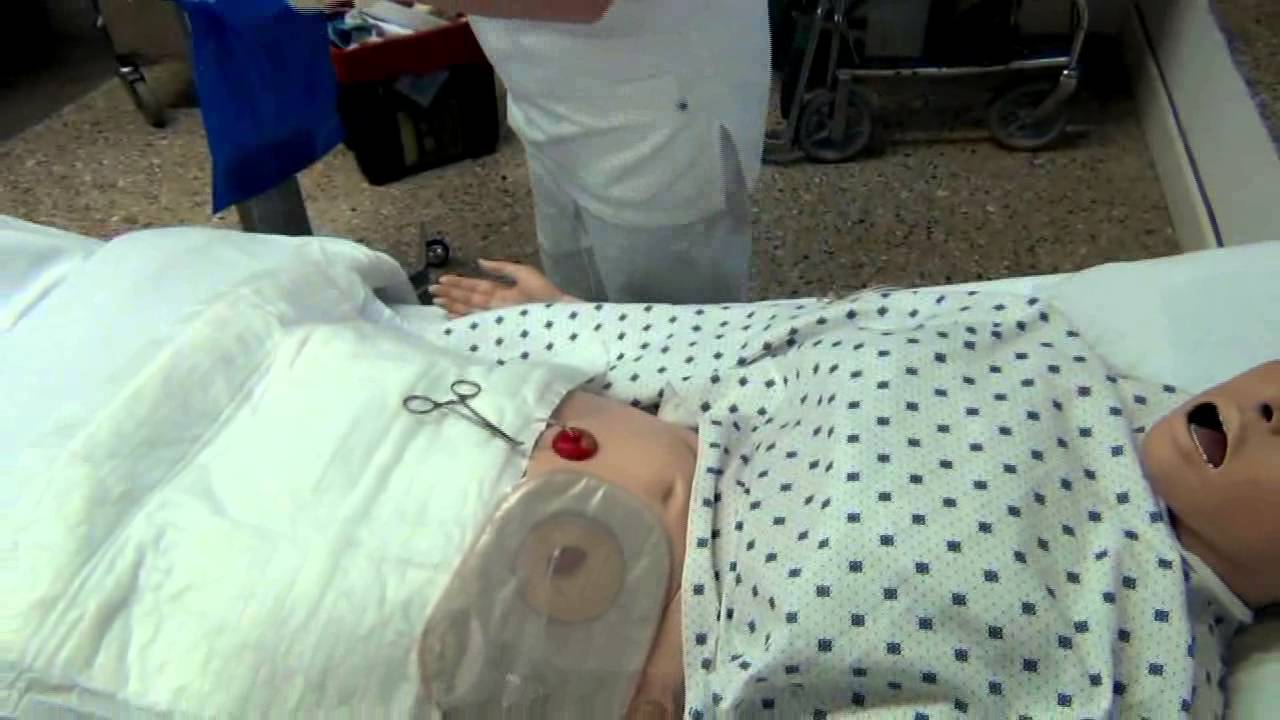 Gestione delle stomie urinarie - UCS - YouTube