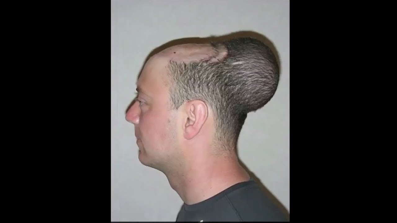 Man's head stretched by BALLOON Глава человека растягивается на ...