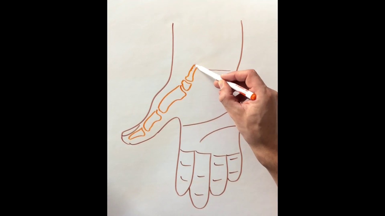 ténosynovite (tendinite) de quervain, douleur pouce - YouTube