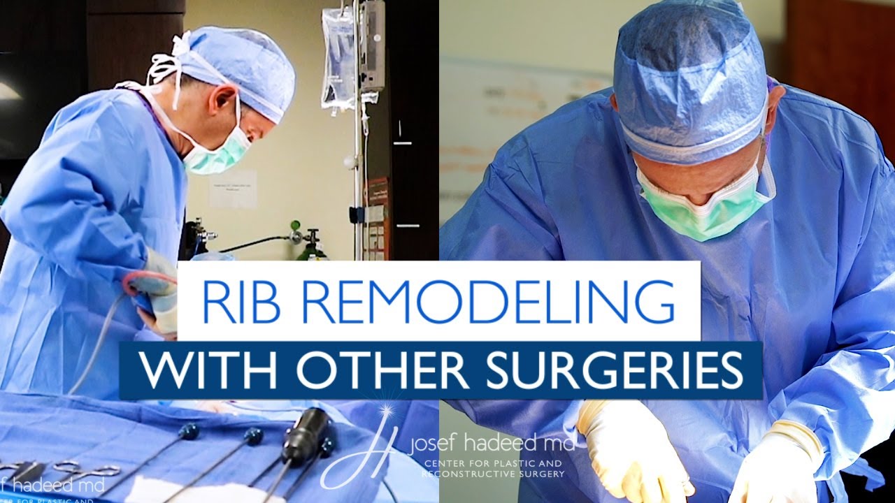 Combining Rib Remodeling with Other Surgeries - YouTube