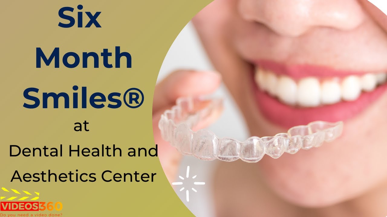 Six Month Smiles® at Dental Health and Aesthetics Center - YouTube