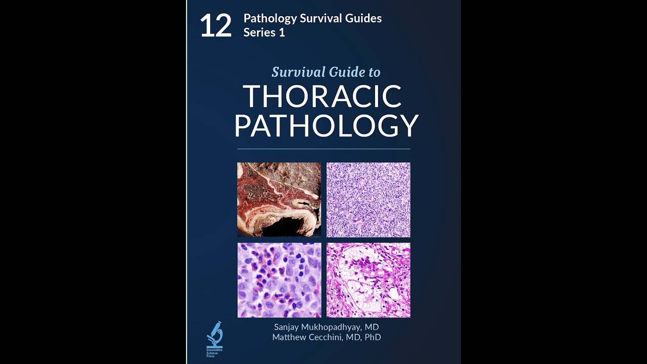 Survival Guide to Thoracic Pathology Trailer - YouTube
