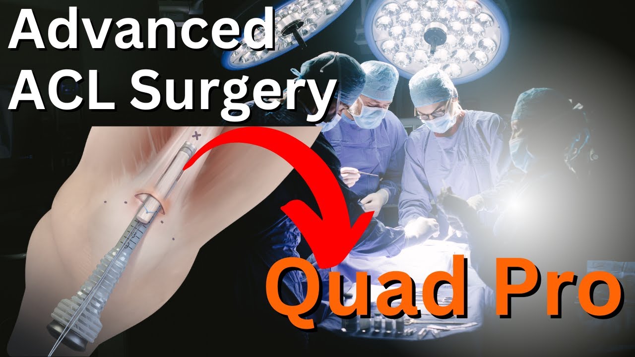 सबसे आधुनिक की जाने वाले ACL Surgery - Quad Pro #physiotherapy # ...
