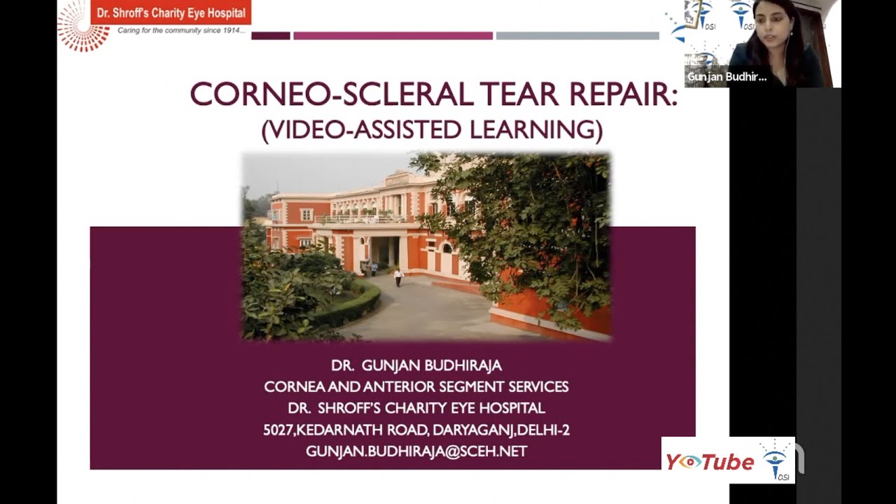 Corneo-Scleral Tear Repair (Video Assisted) - Dr. Gunjan Budhiraja ...