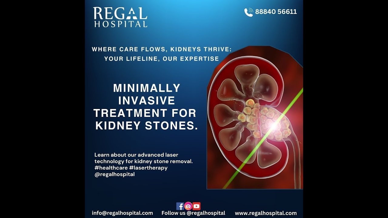 Beyond Relief Transforming Kidney Stone Treatment with Care and ...