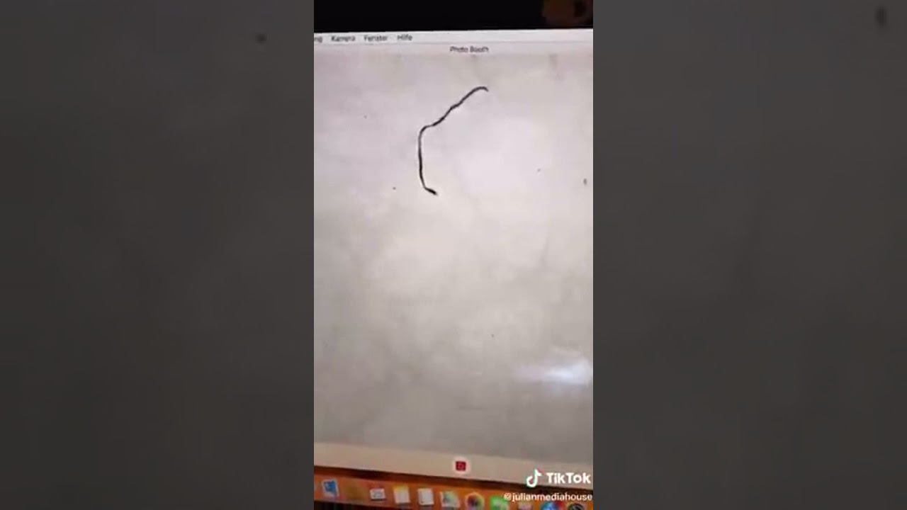 Morgellons Fibers Under Microscope - YouTube