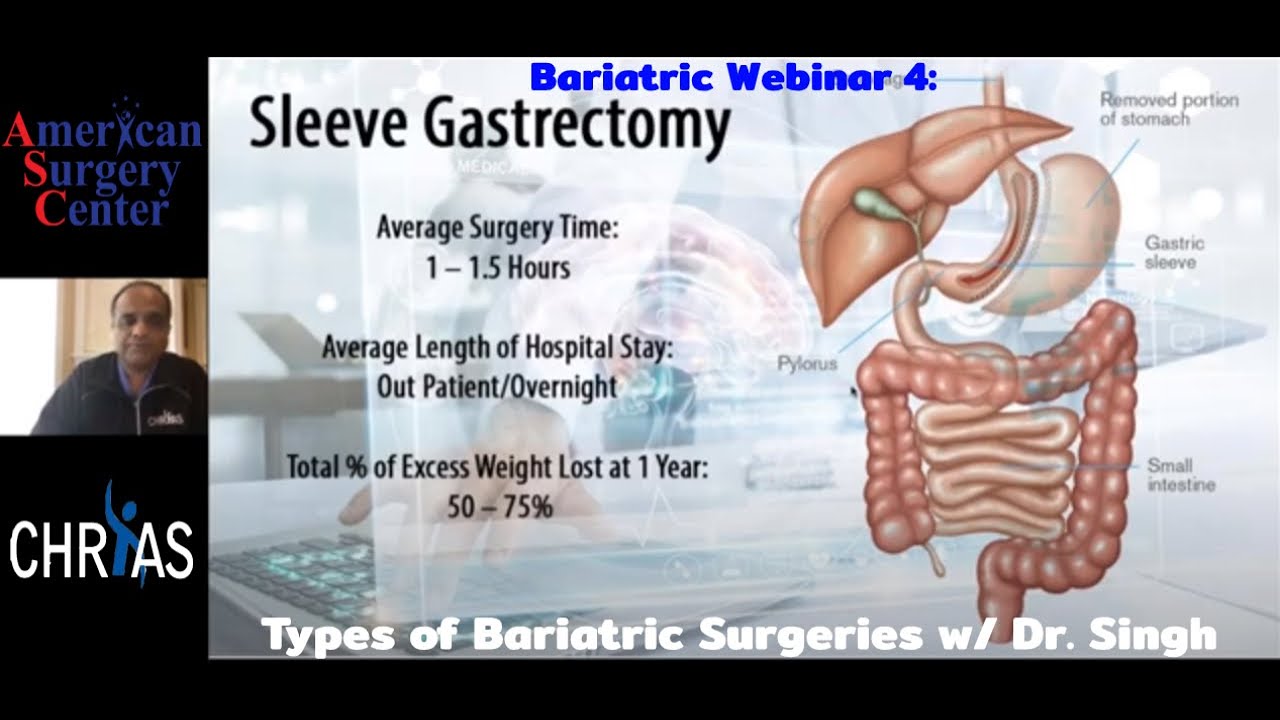 Bariatric Webinar 4: Types of Bariatric Surgeries w/ Dr. Singh (Clip ...