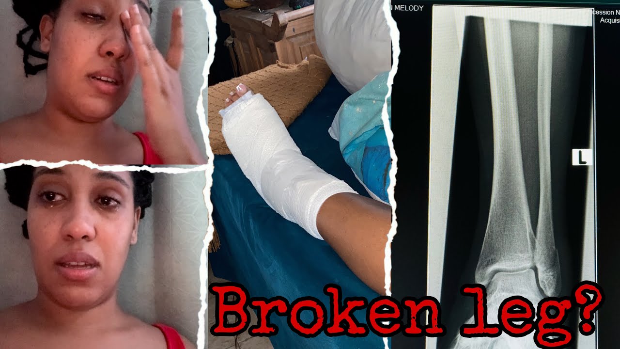 Did Melody “BREAK HER LEG” ⁉️😱. First week into the new year and this ...