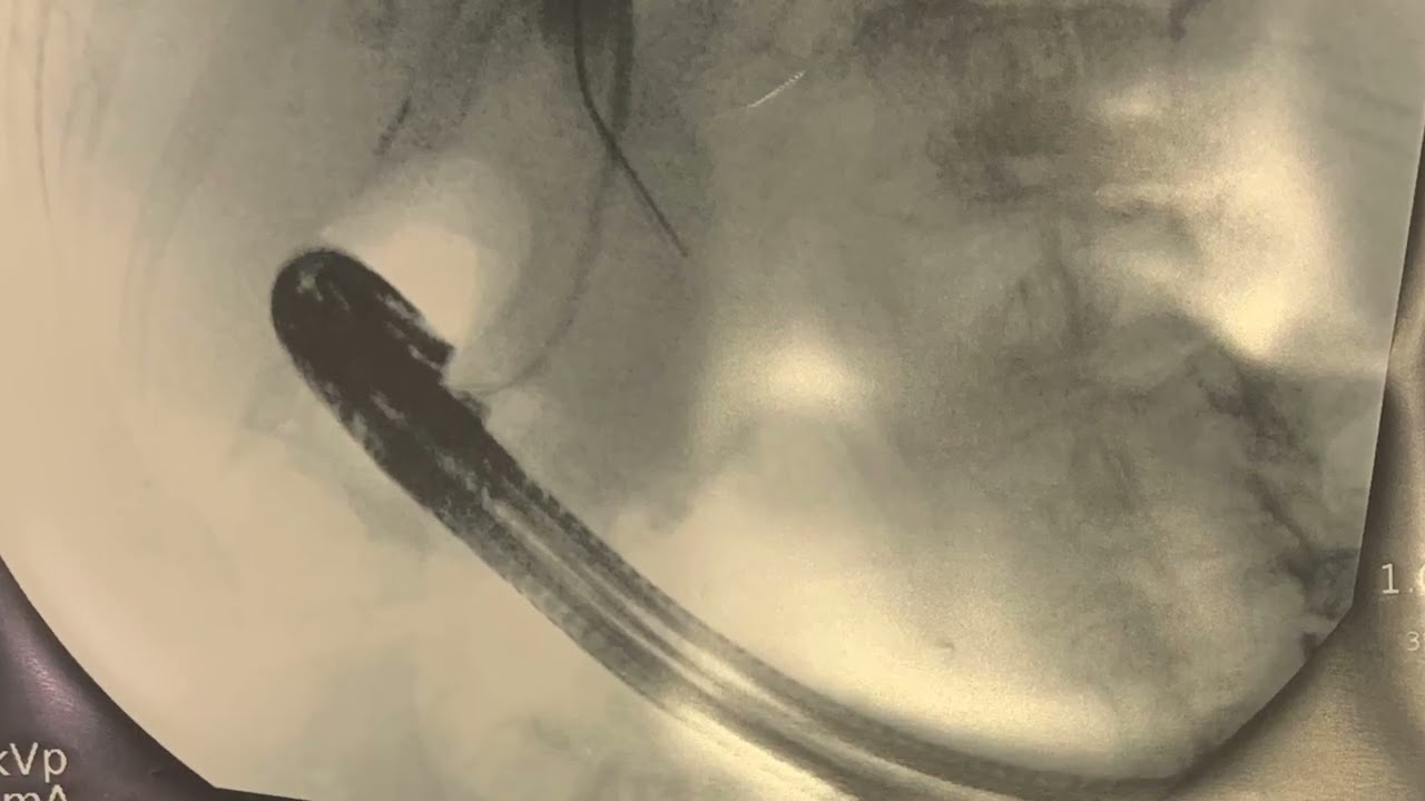 Gastroenterology /Endoscopy Educational Videos - YouTube